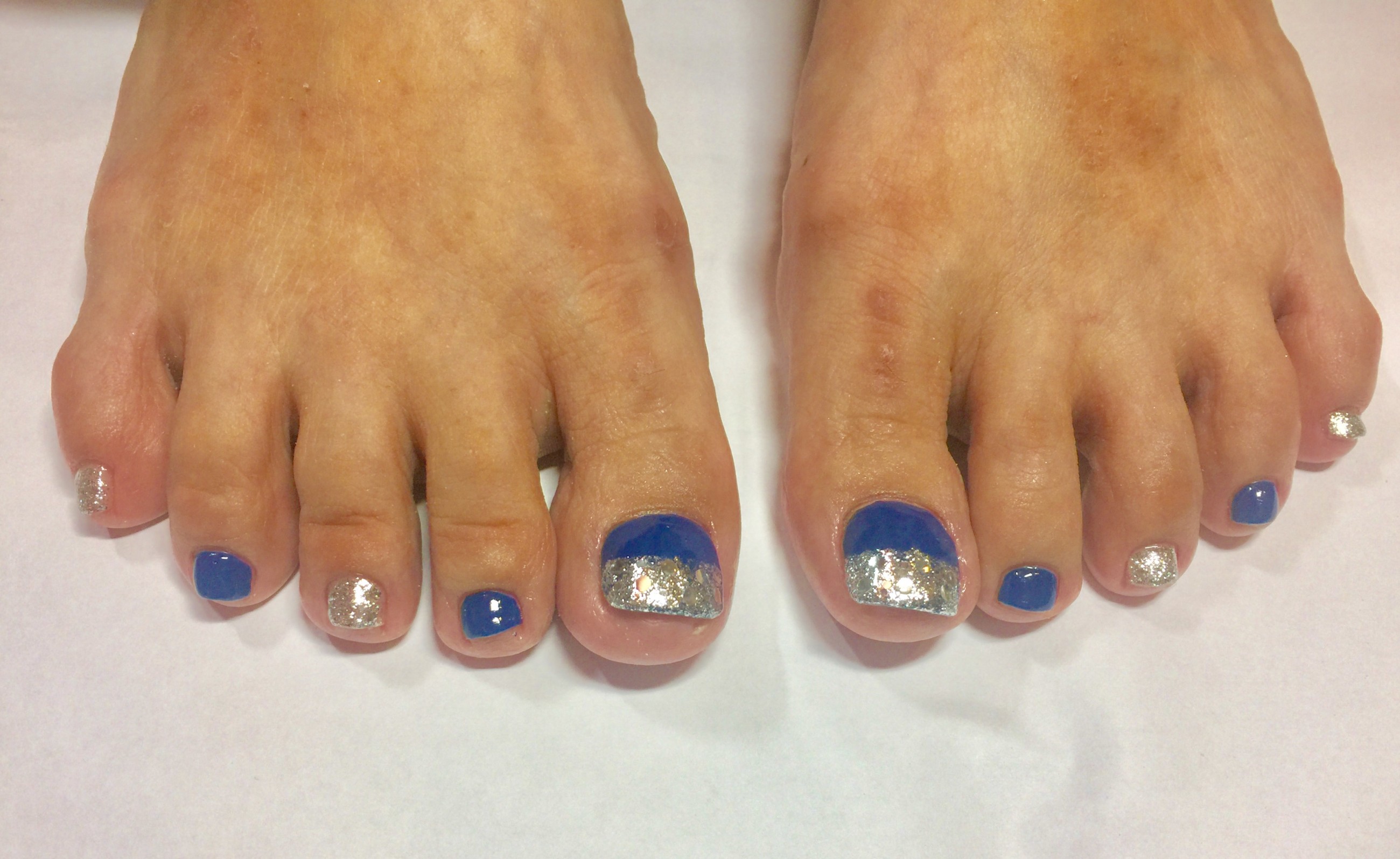 ～足爪のお悩み編～ | 【公式】Lapis Nail ラピスネイル|長崎市のネイルサロン|ネイルスクール